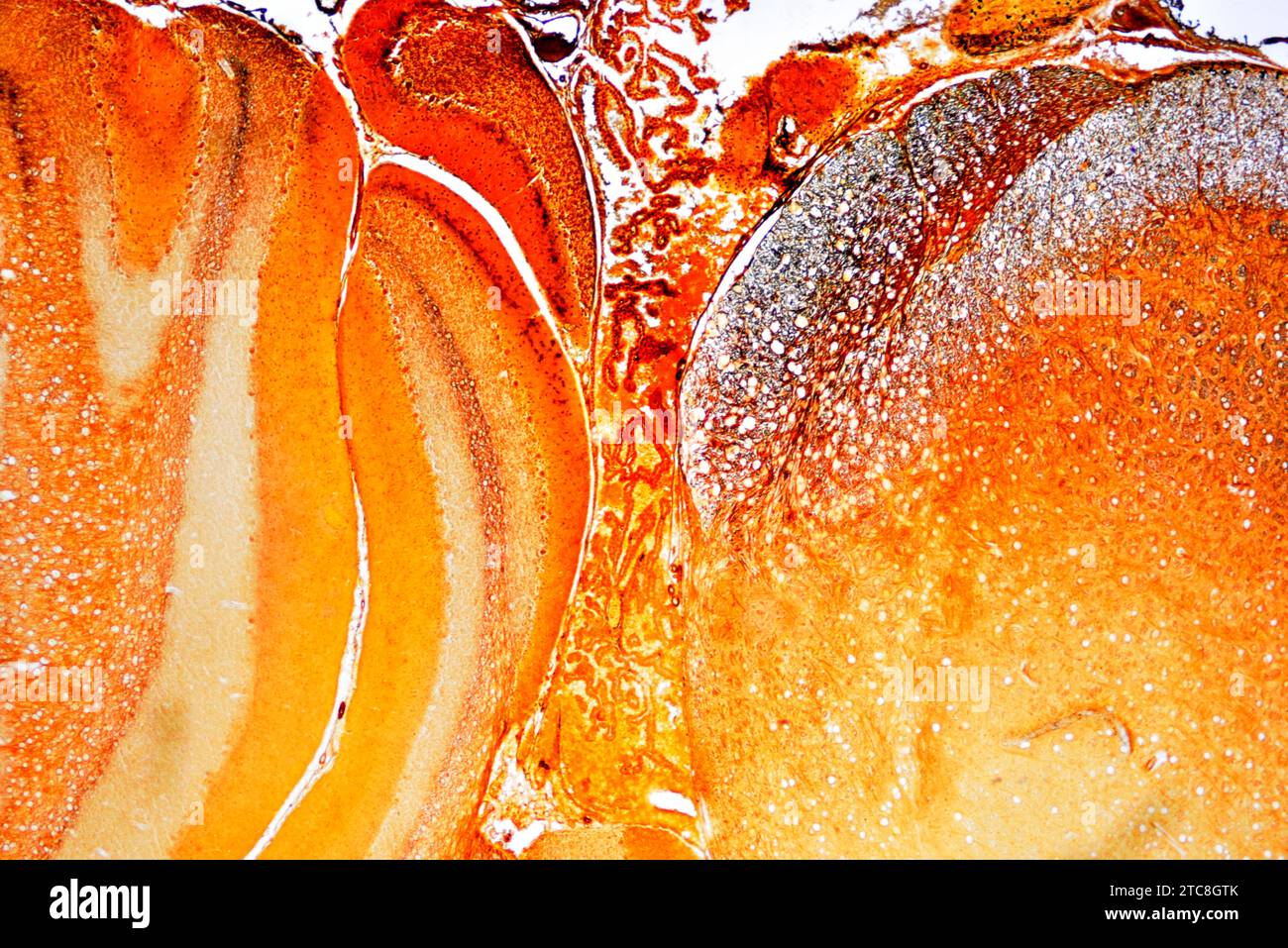 Cerebellum cross section (Cajal stain). Light microscope X40 at 10 cm ...