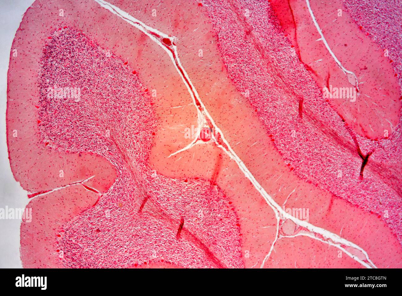 Human cerebellum cross section. Light microscope X40 at 10 cm wide ...
