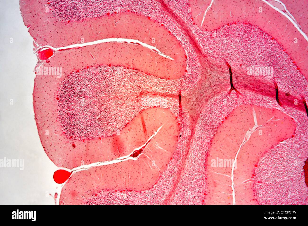 Human cerebellum cross section. Light microscope X40 at 10 cm wide ...