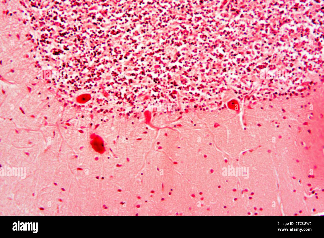 Human cerebellum cross section. Light microscope X300 at 10 cm wide ...