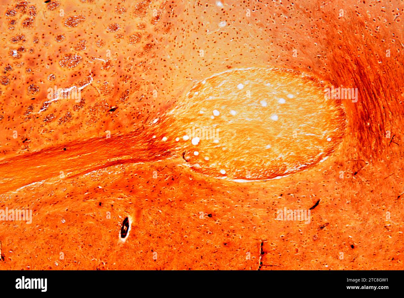 Histology stain hi-res stock photography and images - Alamy