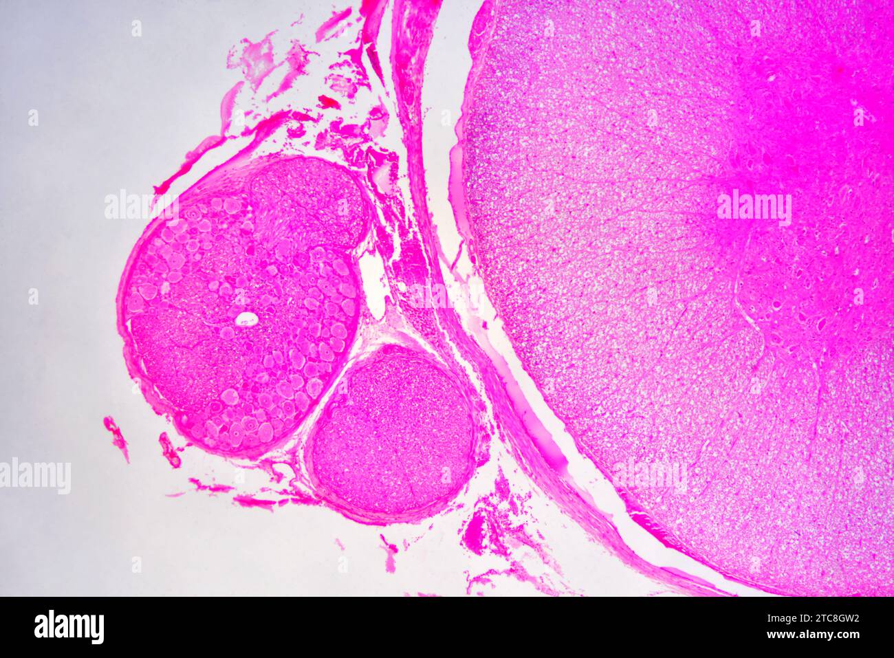 Spinal ganglion cross section. Light microscope X40. at 10 cm wide ...