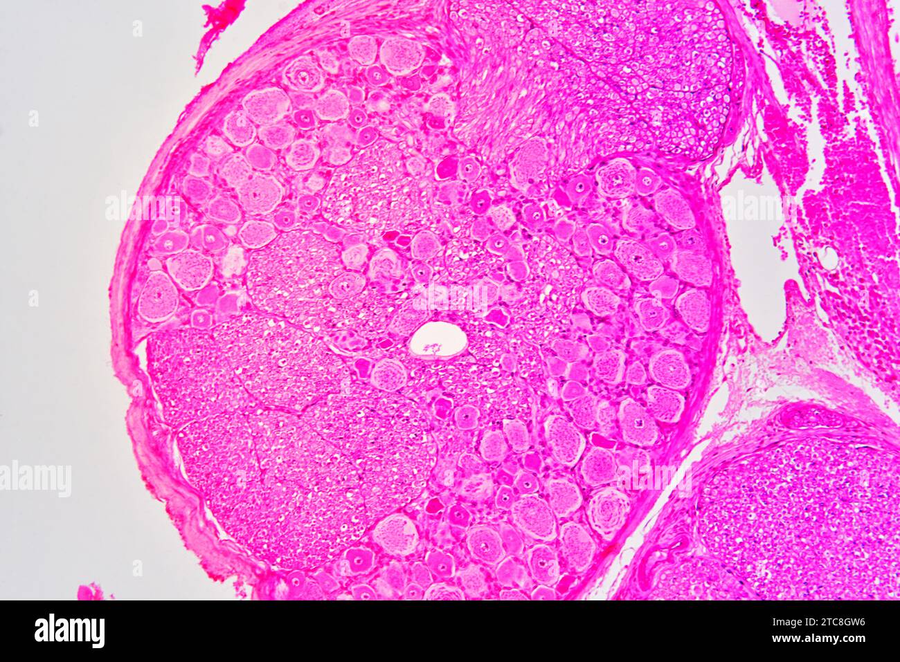 Spinal Ganglion Cross Section Light Microscope X150 At 10 Cm Wide