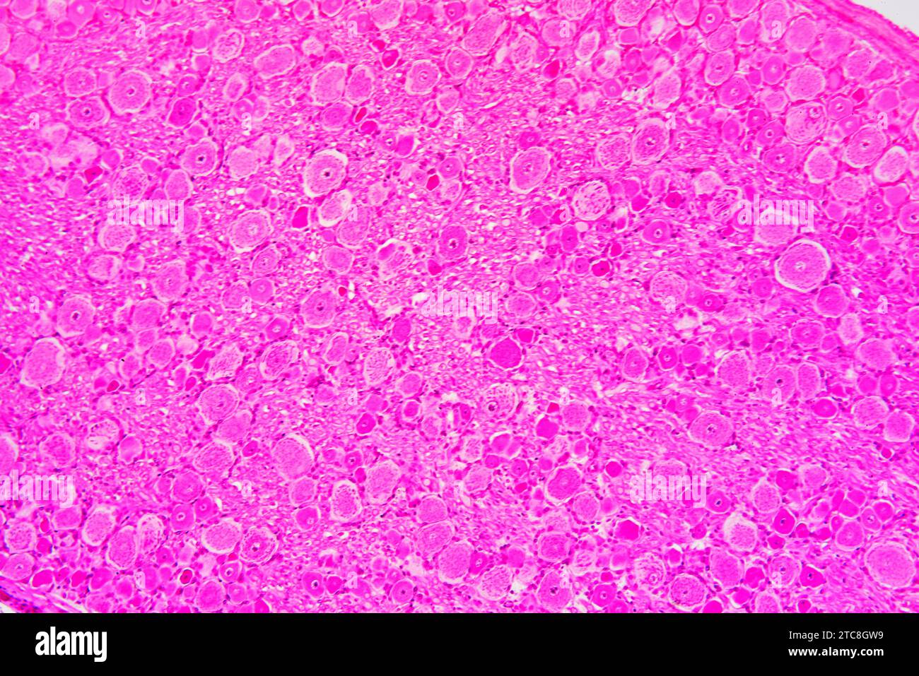 Spinal Ganglion Cross Section Light Microscope X150 At 10 Cm Wide