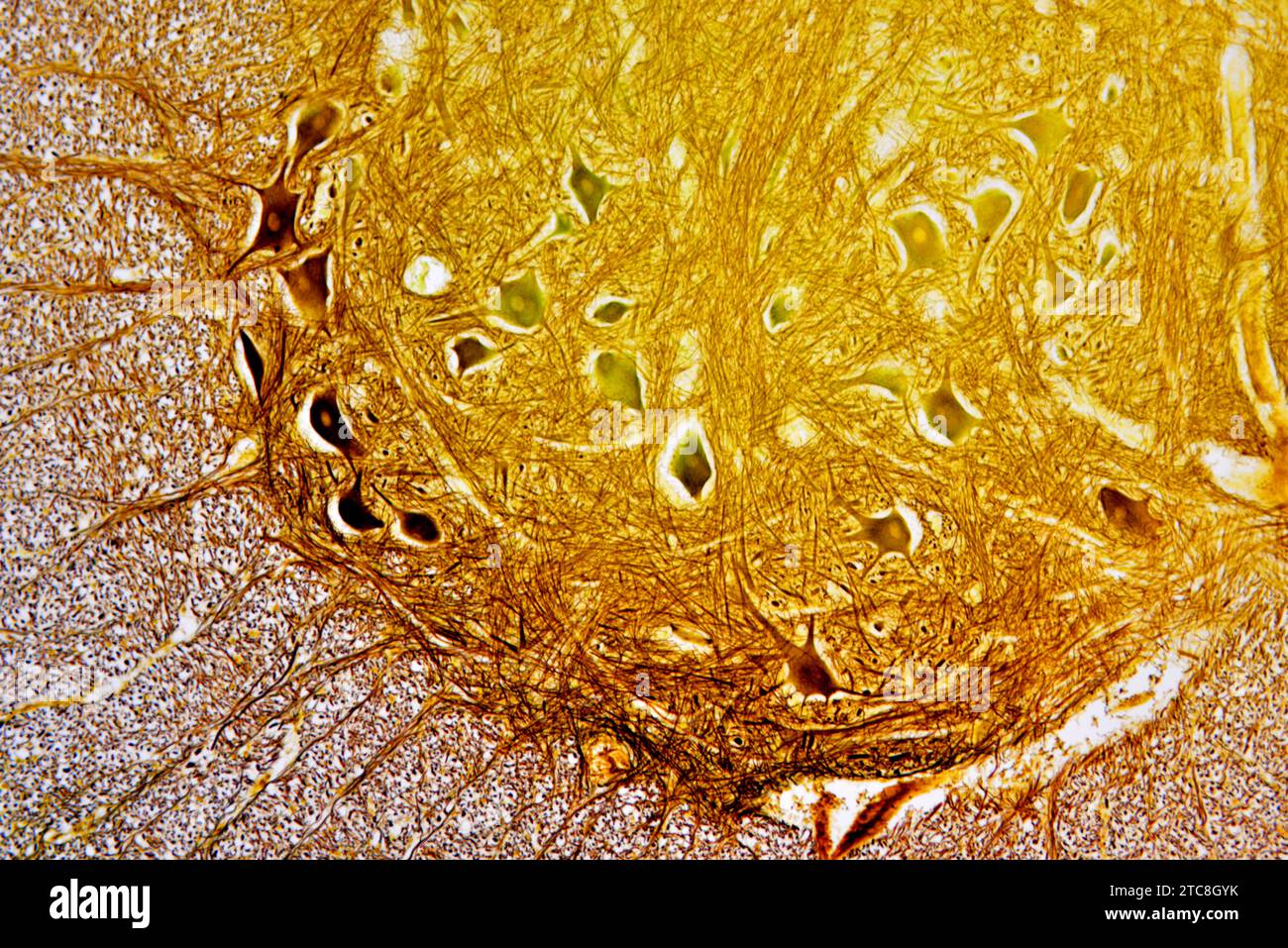 Spinal cord cross section showing neurones and glia cells. Light ...
