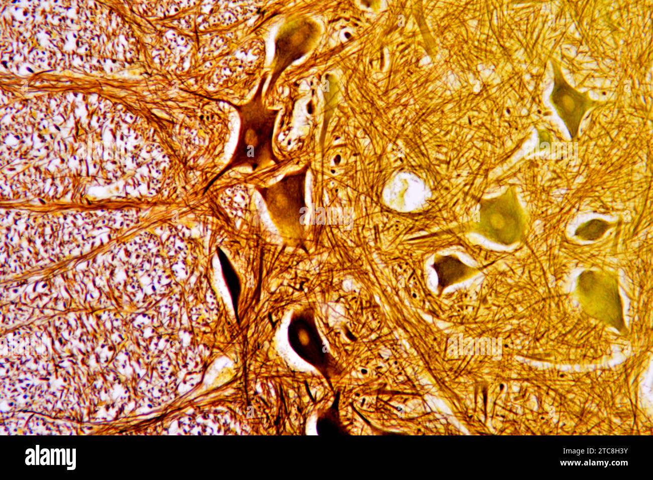Spinal cord cross section showing neurones and glia cells. Light ...
