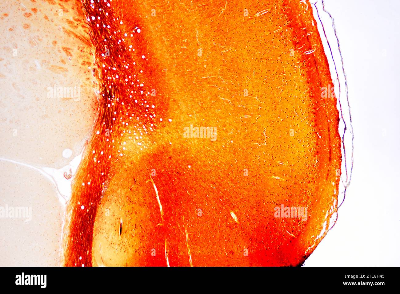 Meninges Cajal stain. Light microscope X40 at 10 cm wide Stock Photo ...