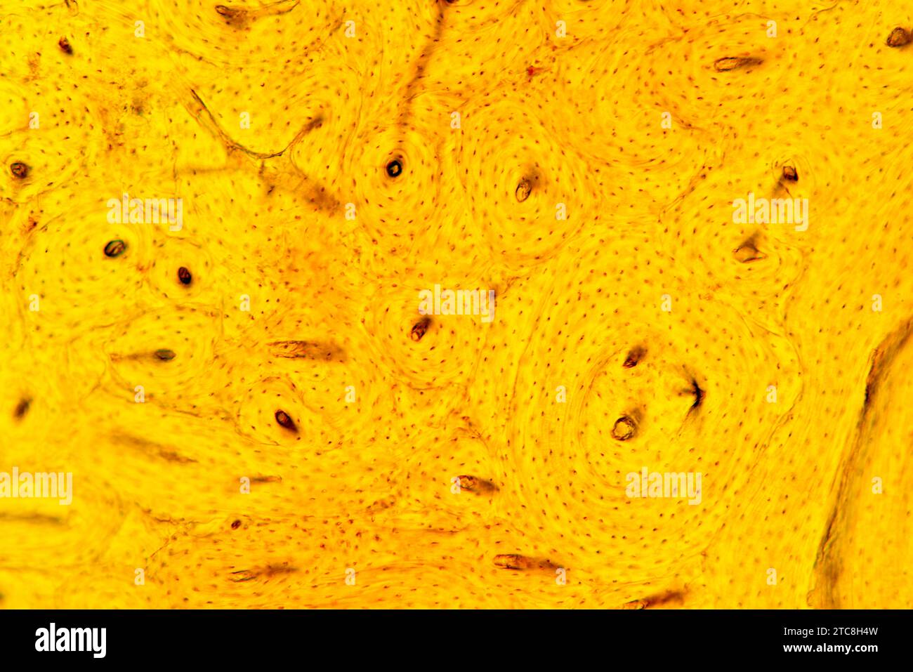 Cortical bone tissue showing Haversian canals, osteons, osteocytes and ...