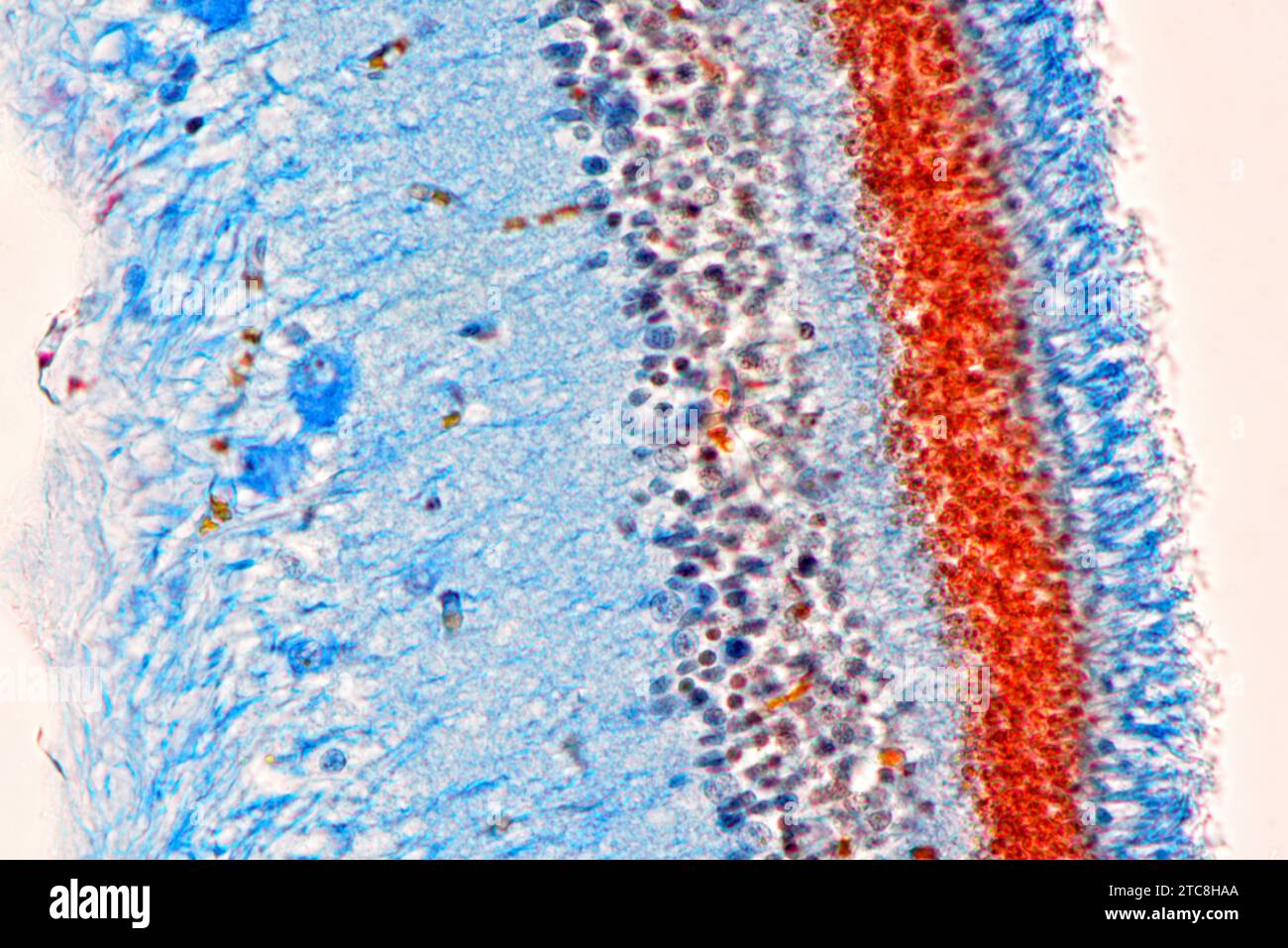 Cat eye retina showing cones and rods. Optical microscope X300 at 10 cm ...
