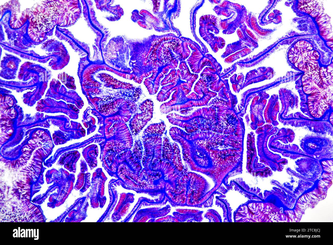 Sea anemone (Actinia sp.), cross section showing ectoderm, mesoglea ...