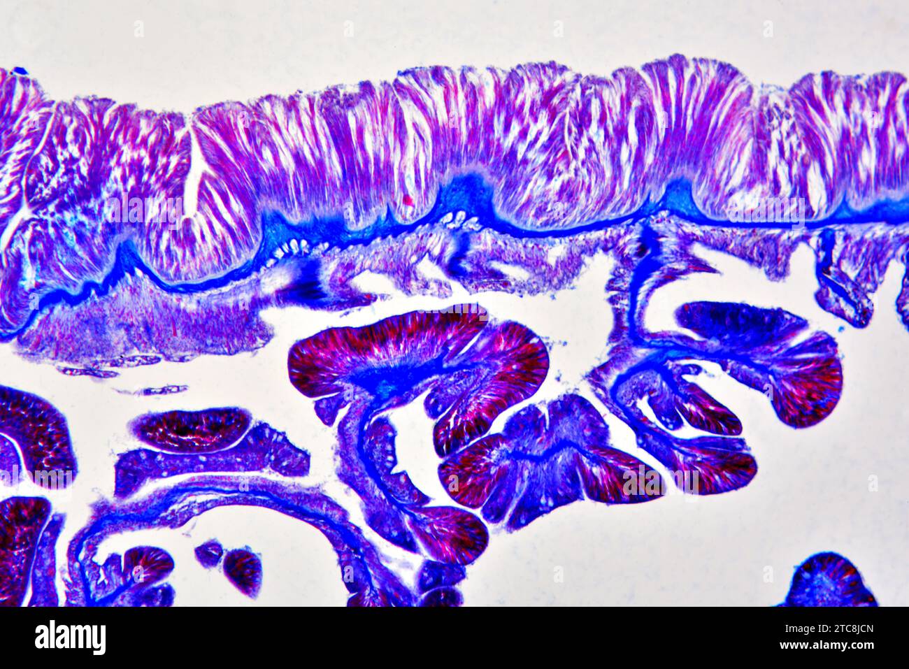 Sea anemone (Actinia sp.), longitudinal section showing ectoderm ...