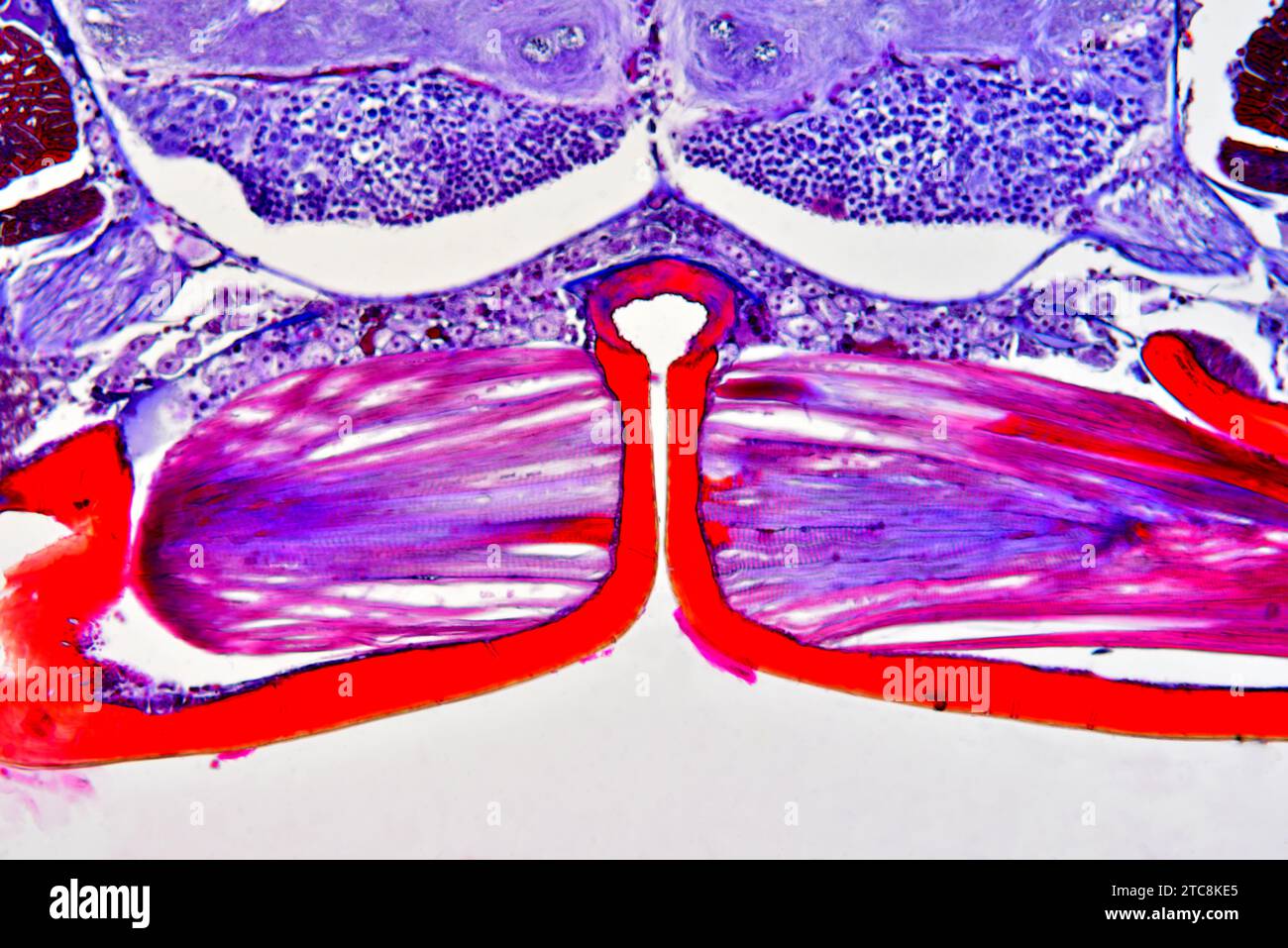 Garden spider (Araneus sp.) cephalothorax cross section showing chitin ...