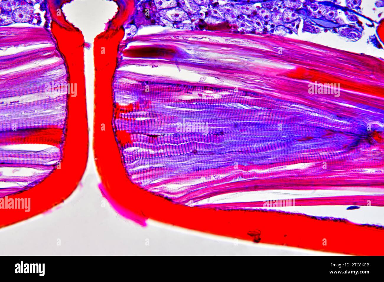 Garden spider (Araneus sp.) cephalothorax cross section showing chitin ...