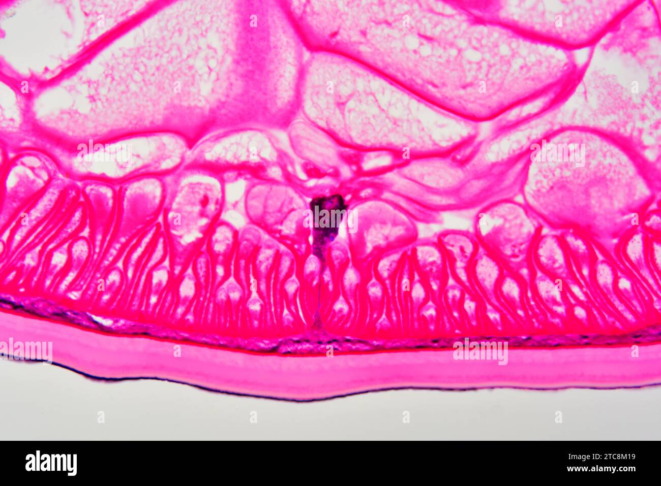 Ascaris lumbricoides female showing cuticle, epithelium, longitudinal ...