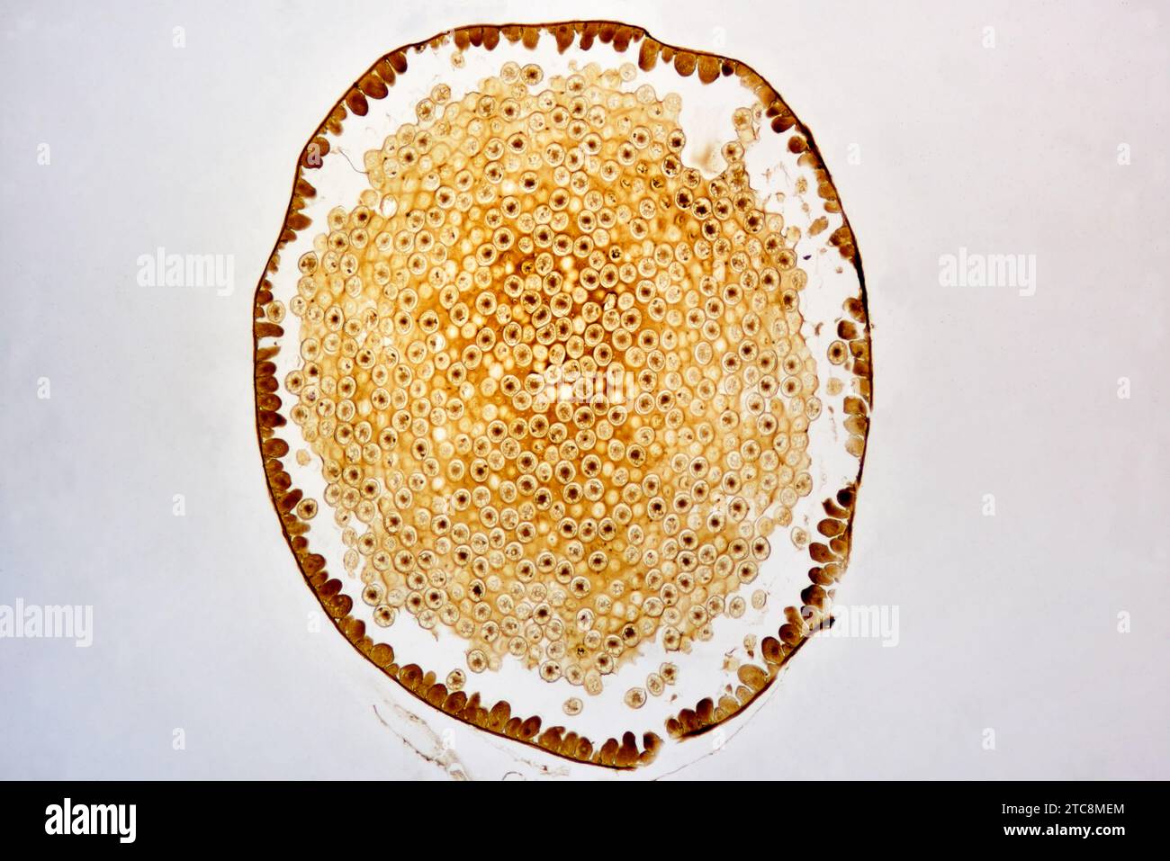 Ascaris megalocephala female, uterus with meiosis. Horse intestine ...