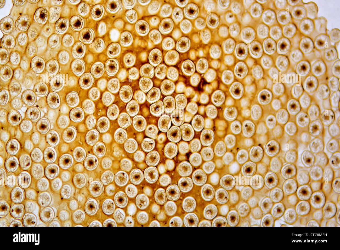 Ascaris megalocephala female, uterus with meiosis. Horse intestine ...
