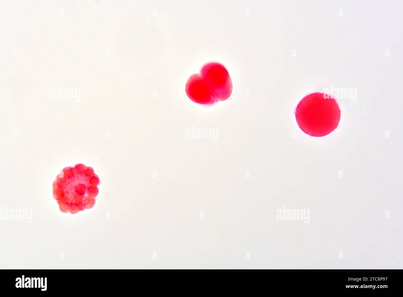 Sea urchin, morula and blastula. Light microscope X150 at 10 cm wide ...