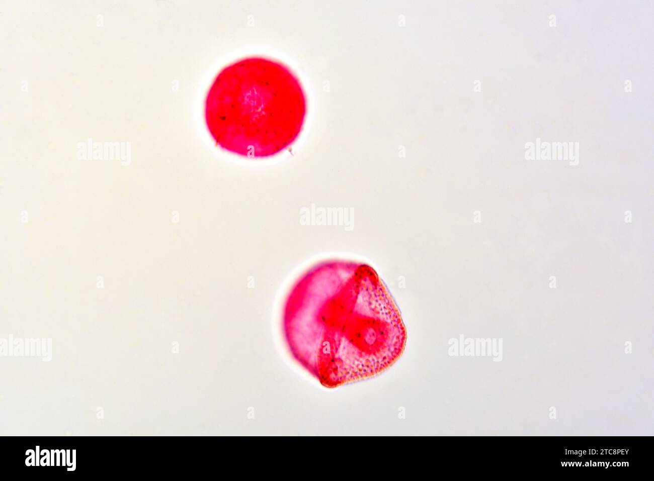 Sea urchin, blastula and gastrula. Light microscope X300 at 10 cm wide ...