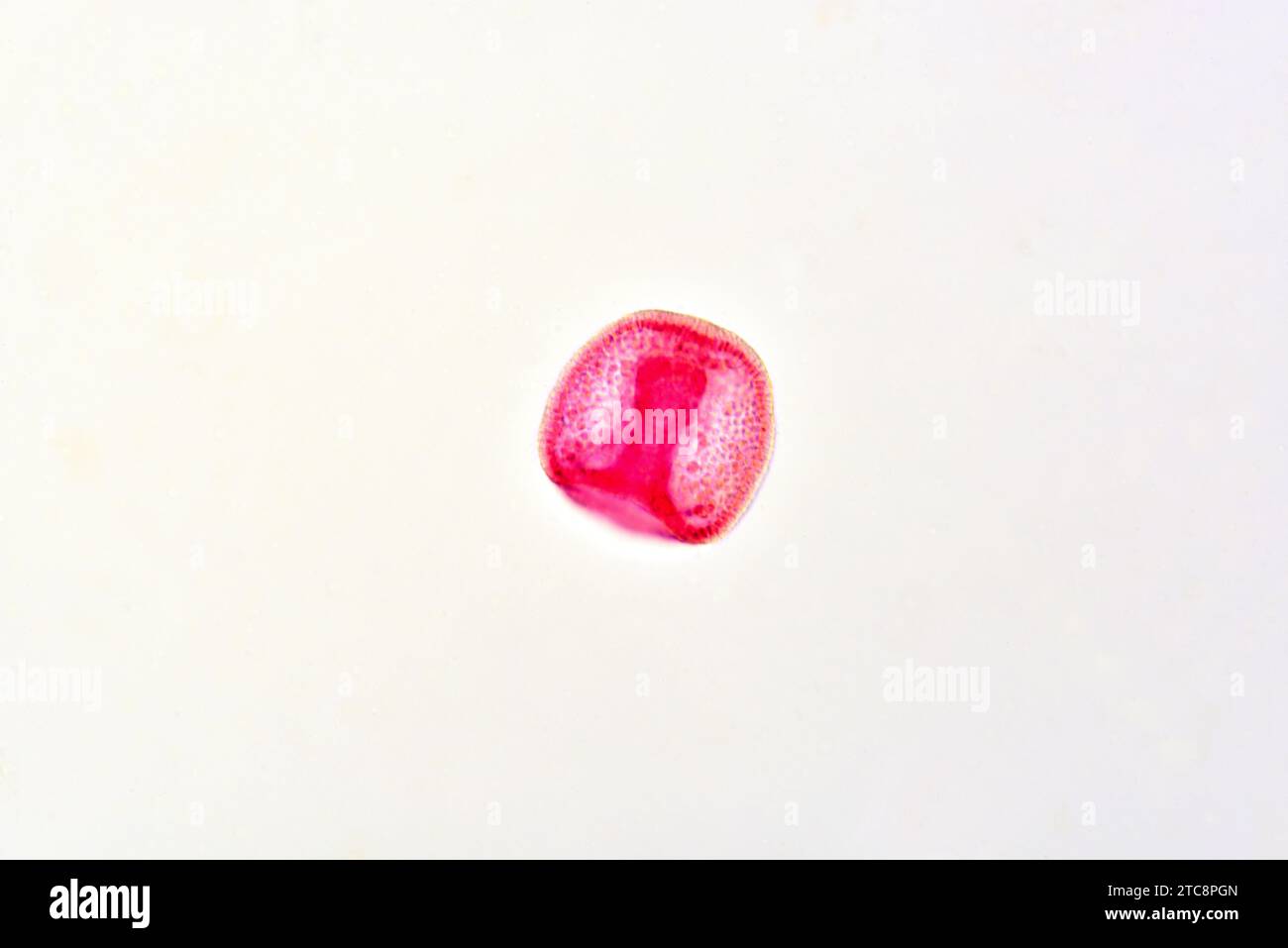 Sea urchin, gastrula. Light microscope X300 at 10 cm wide Stock Photo ...