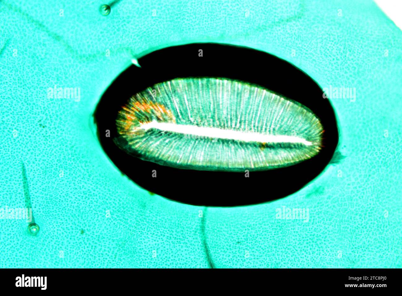 Insect spiracle. Light microscope X150 at 10 cm wide Stock Photo - Alamy