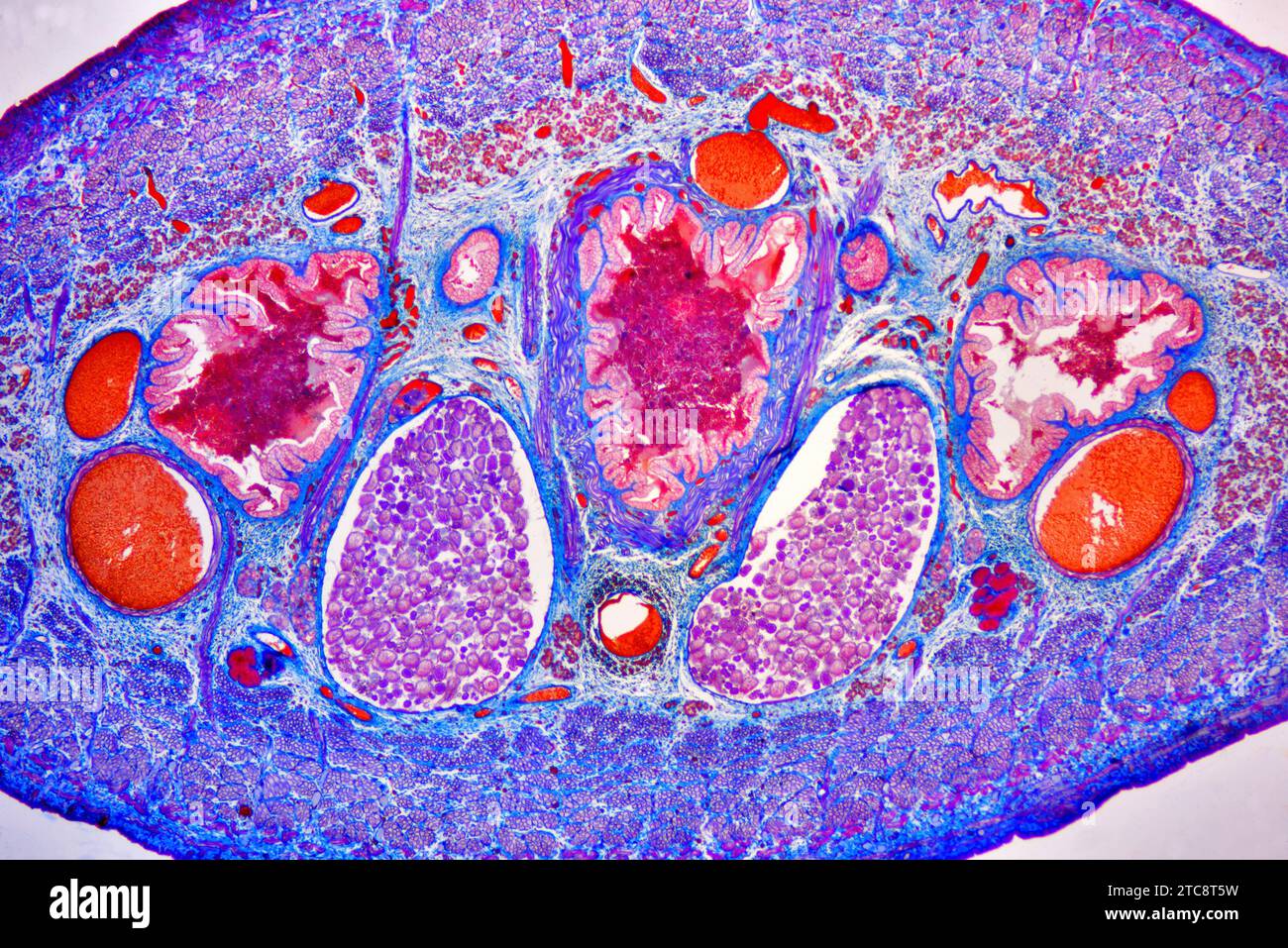 European medicinal leech (Hirudo medicinalis) cross section showing ...
