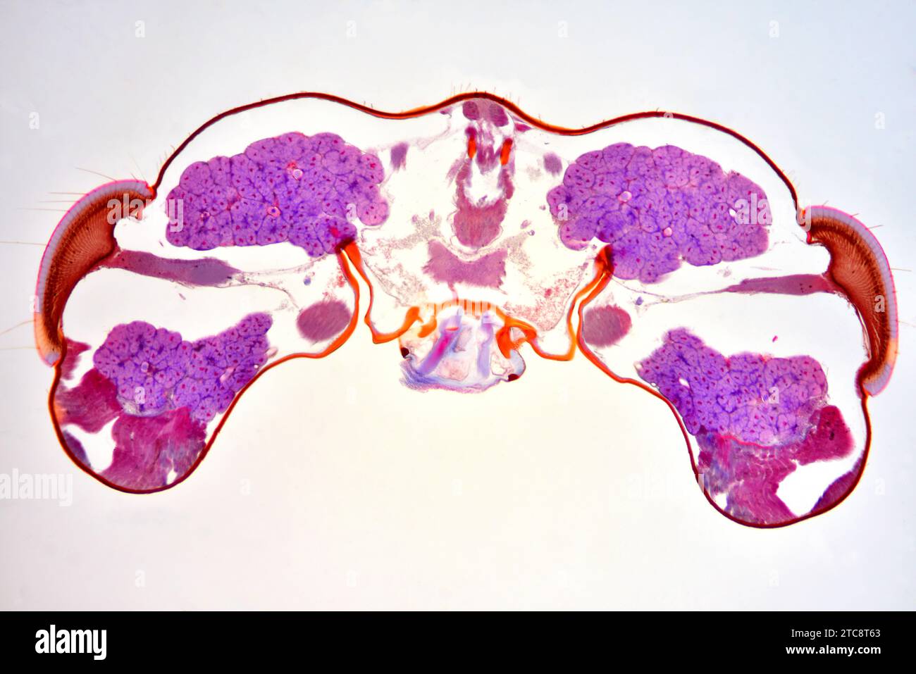 Insect head, cross section showing brain, compound eyes, optic nerves ...