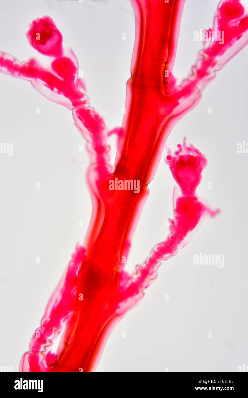 Sea fur (Obelia sp.) polyp stage. Light microscope X150 at 10 cm wide ...