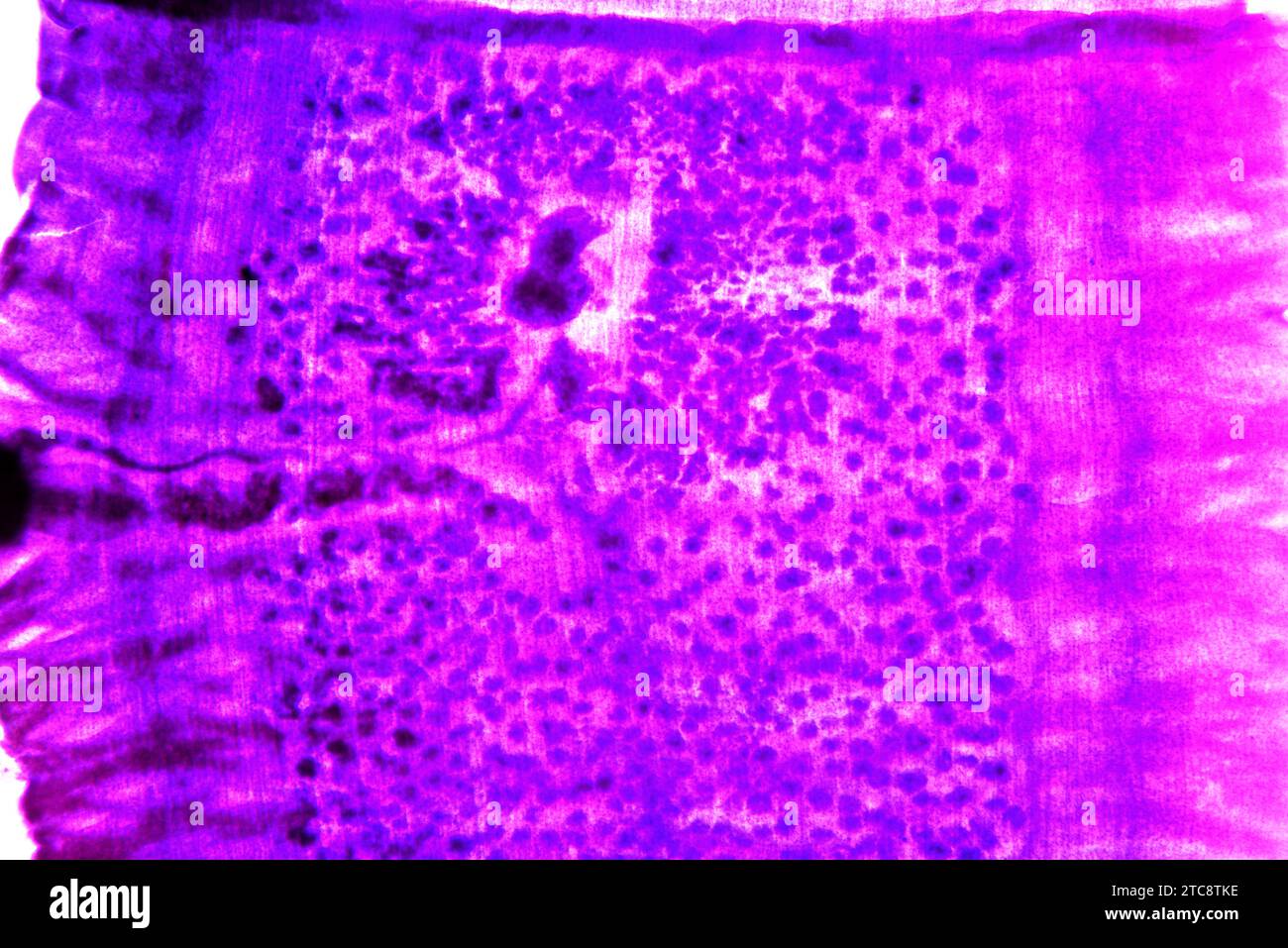 Rabbit tapeworm (Taenia pisiformis) proglottid with ovaries, testes and ...
