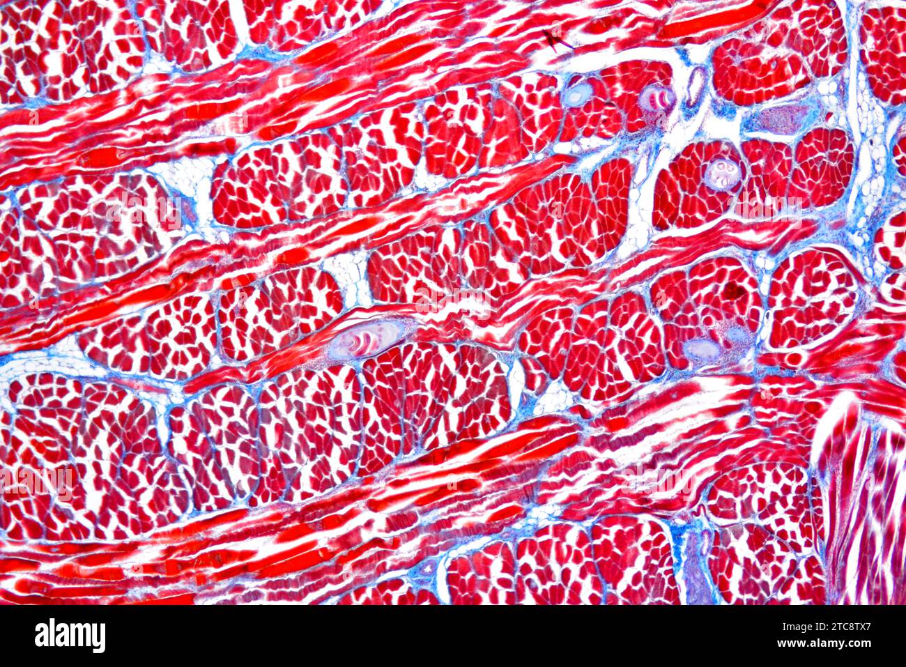 Pork worm larvae (Trichinella spiralis) in a muscular tissue. Light ...