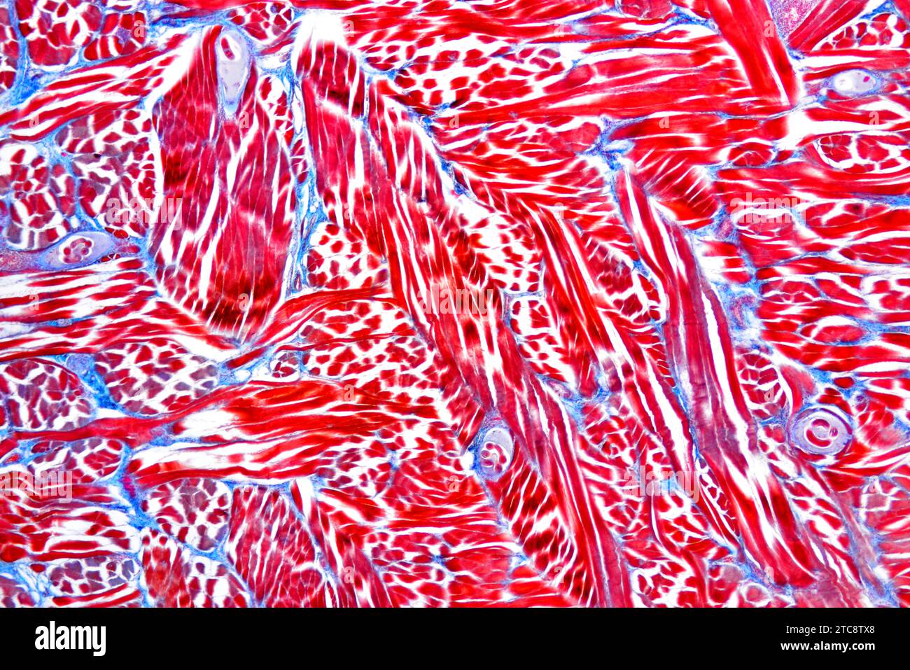 Trichinella spiralis hi-res stock photography and images - Alamy