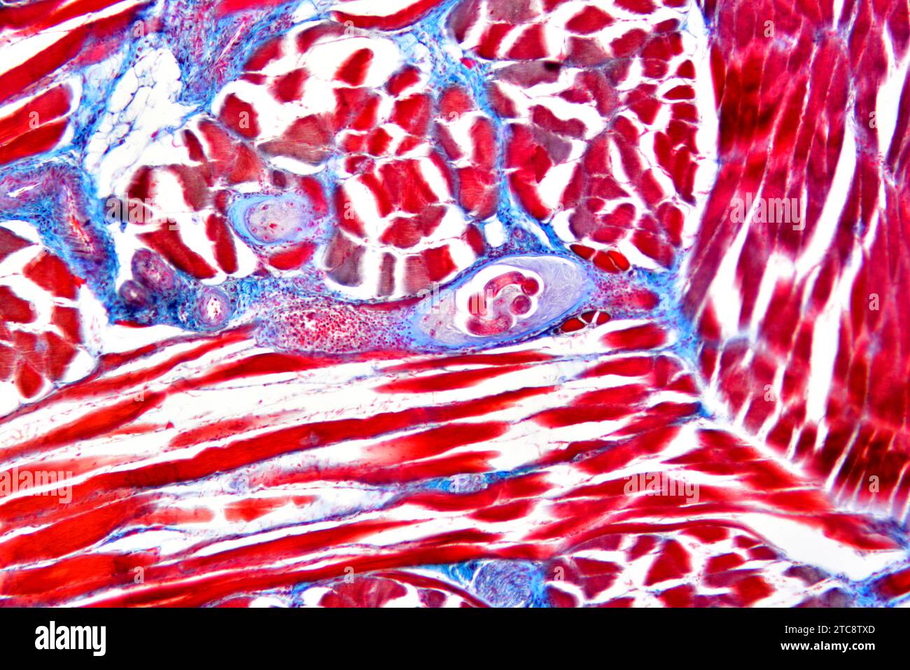 Pork worm larvae (Trichinella spiralis) in a muscular tissue. Light ...