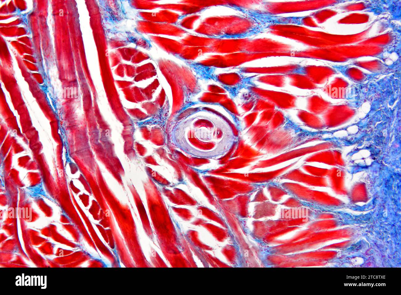 Trichinella spiralis hi-res stock photography and images - Alamy