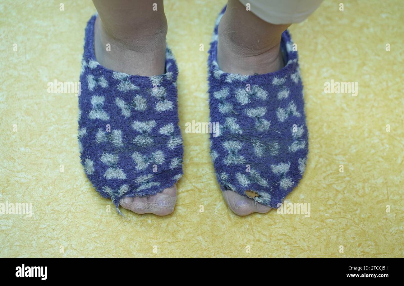 Worn out blue slippers. Home shoes, environment. Tights. Legs. Part of ...
