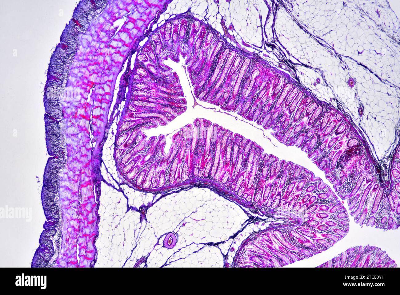 Human colon showing epithelium, mucosa, submucosa, muscular layer ...
