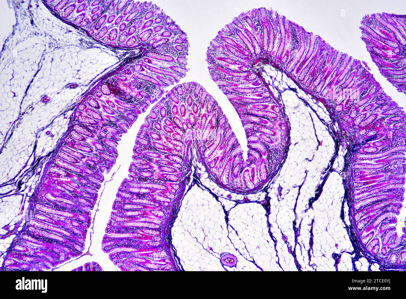 Human colon showing epithelium, mucosa, submucosa, adipose tissue ...