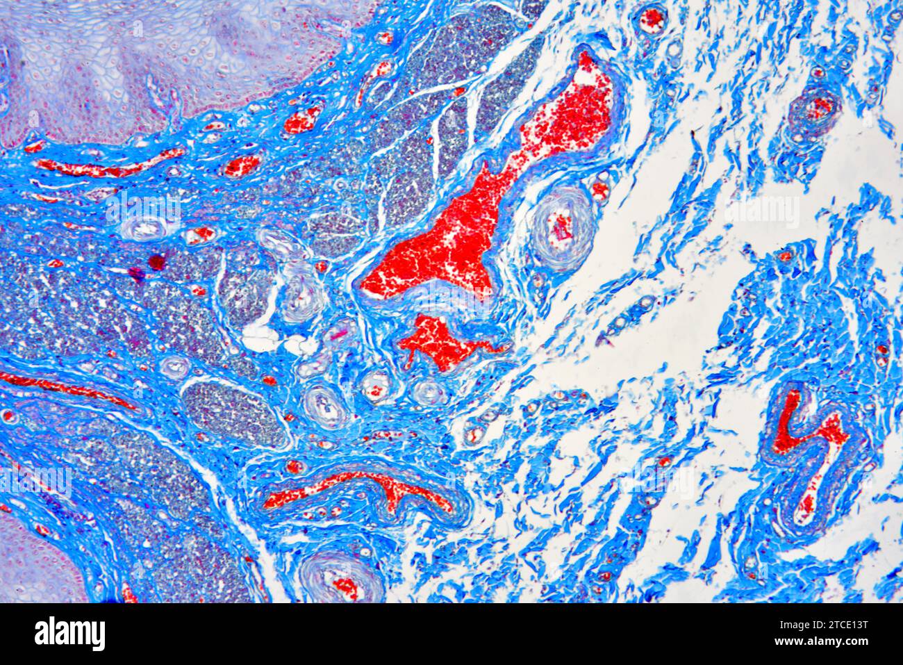 Human esophagus or oesophagus showing squamous epithelium stratified ...