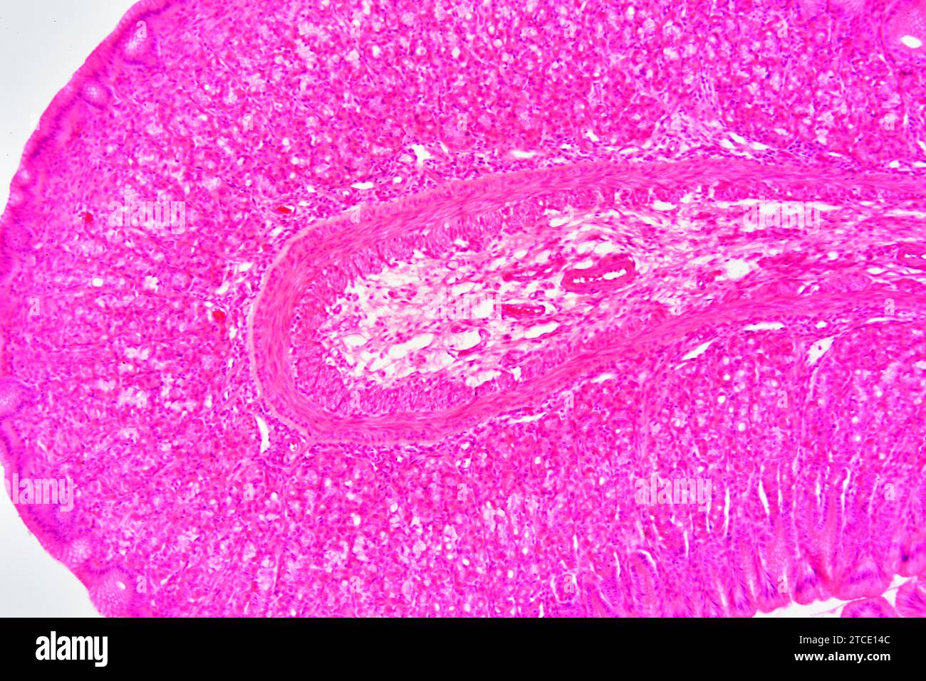 Stomach cross section showing mucosa, submucosa, muscular layer and ...