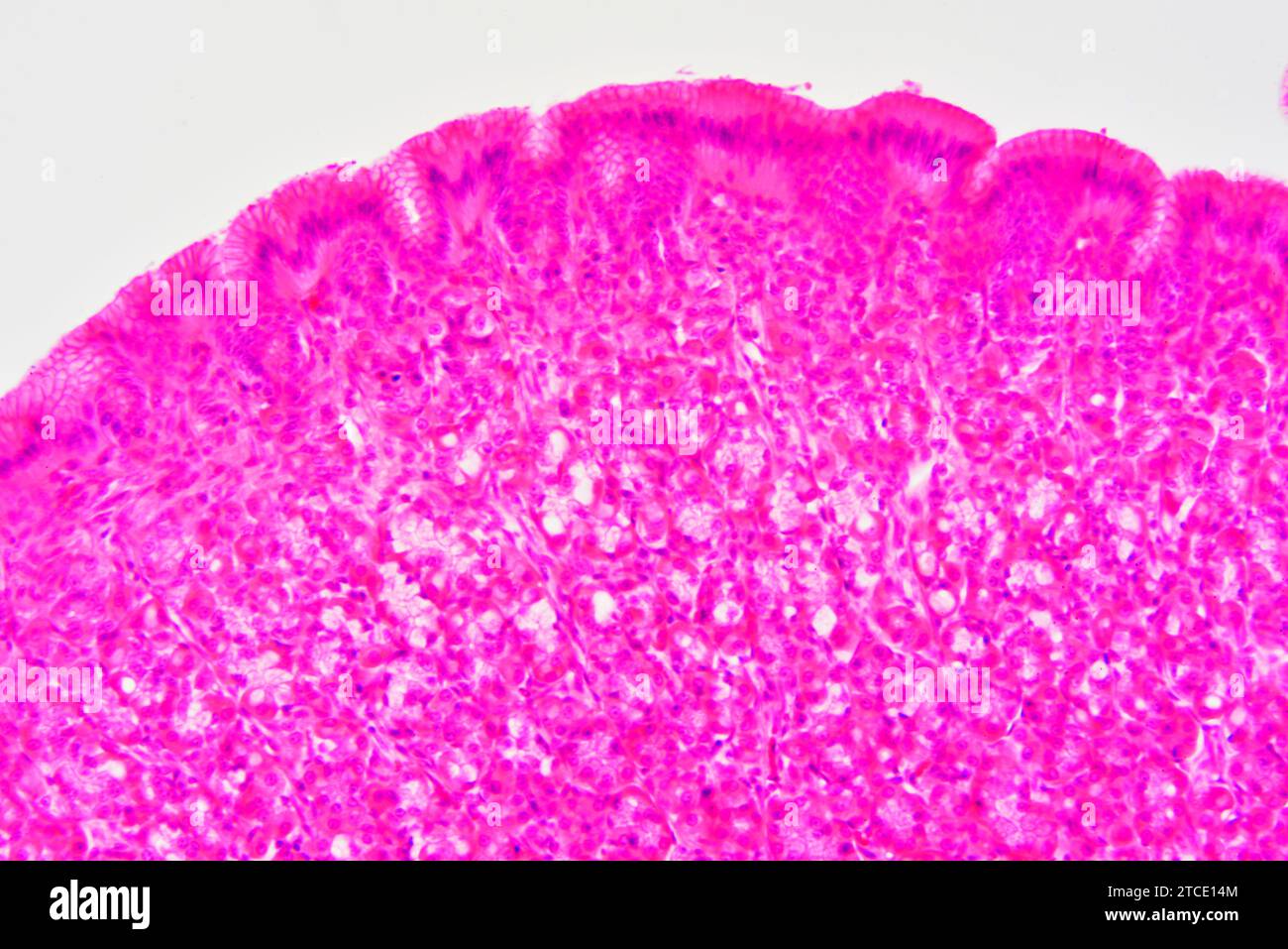 Stomach cross section showing mucosa, submucosa and gastric glands ...