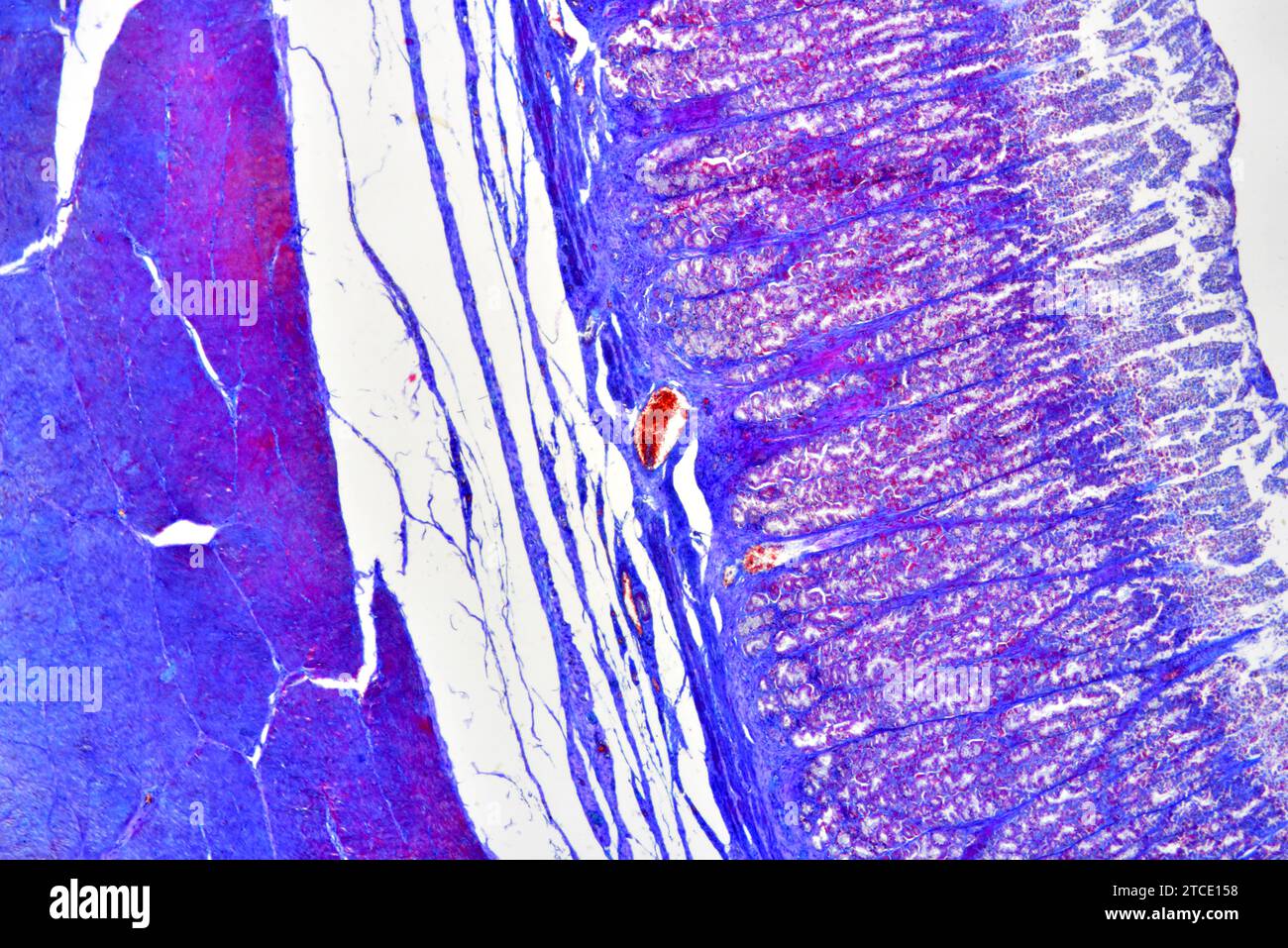 Fundic region hi-res stock photography and images - Alamy