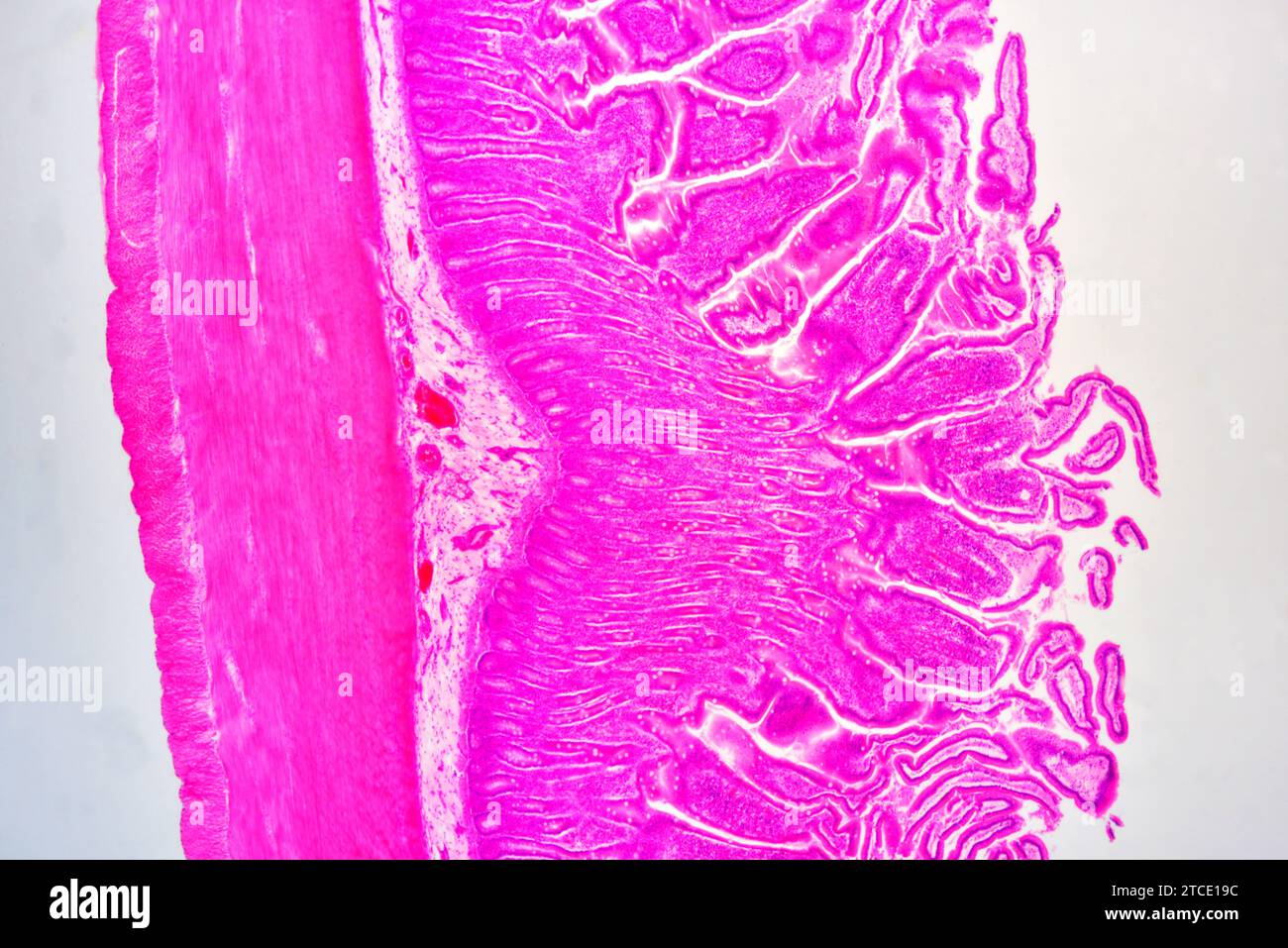 Small intestine cross section showing mucosa, submucosa, lamina propria ...