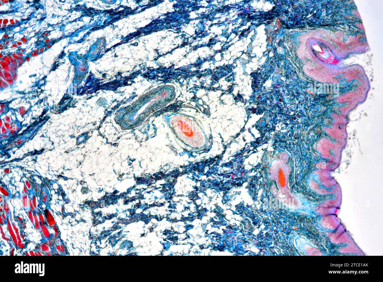 Large intestine microscope hi-res stock photography and images - Alamy