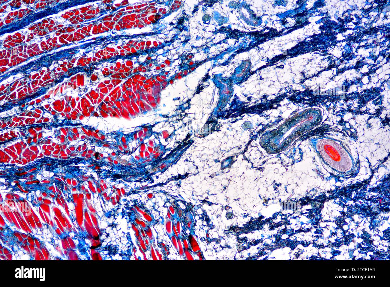 Rectum (large intestine) showing connective tissue, muscular tissue ...