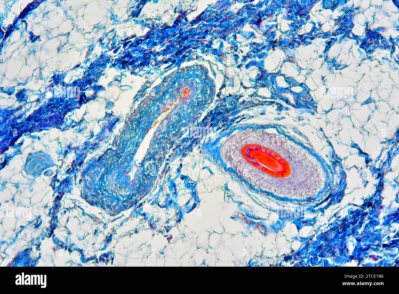 Large intestine microscope hi-res stock photography and images - Alamy