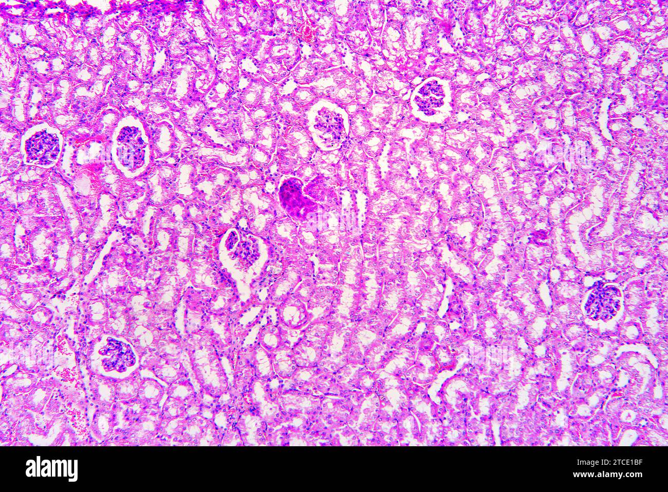 Kidney section showing nephrons, Bowman capsules, glomerulus and distal ...