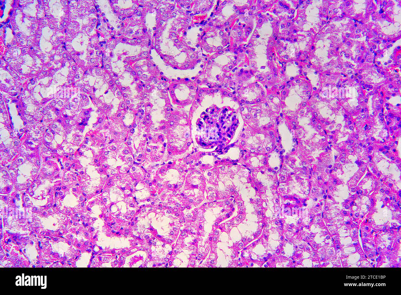 Kidney section showing nephrons, Bowman capsules, glomerulus and distal ...