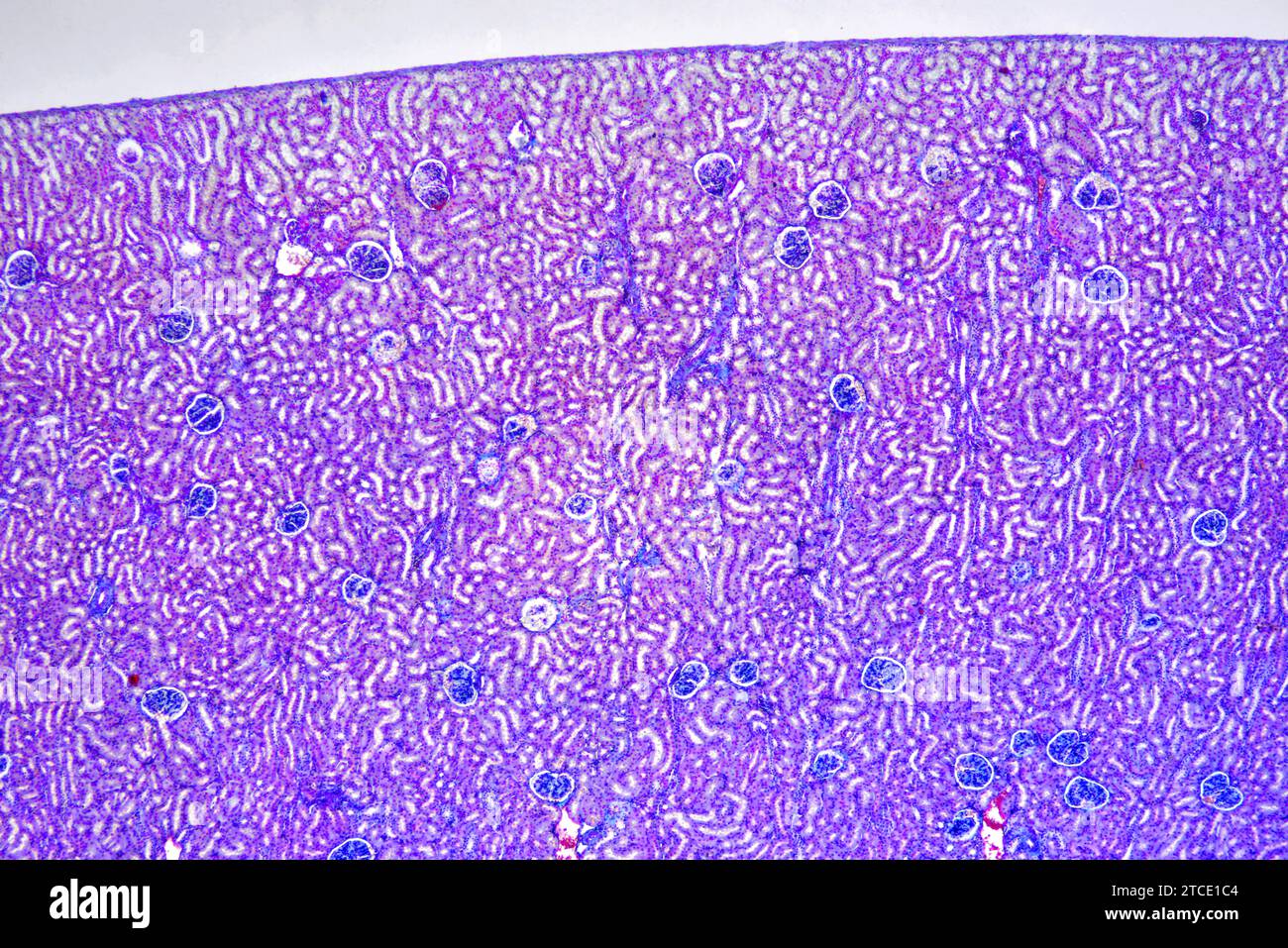 Human kidney (renal cortex section) showing nephrons, Bowman capsules ...