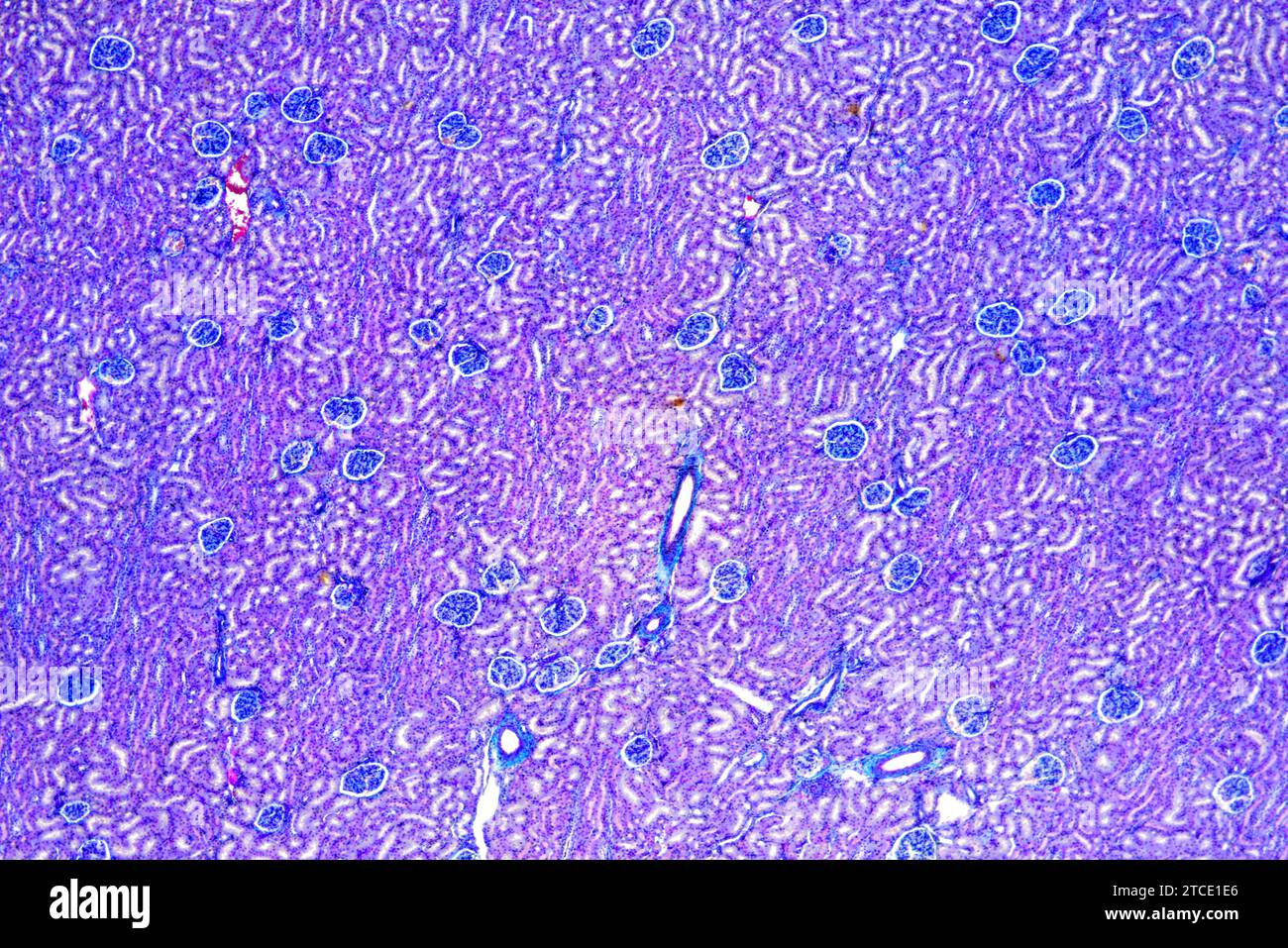 Renal cortex hi-res stock photography and images - Alamy