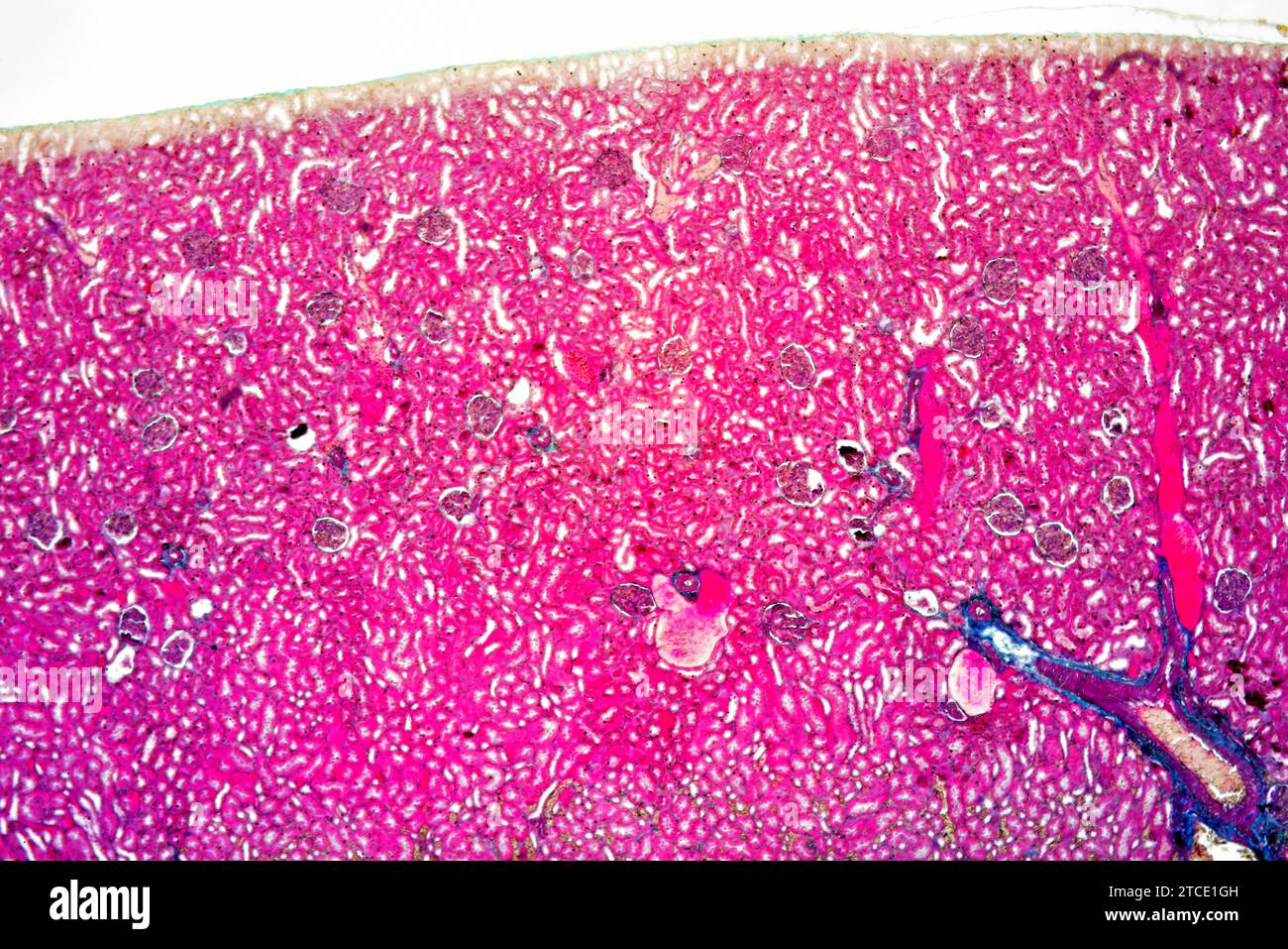 Kidney (cortex renal section) showing nephrons, Bowman capsules ...
