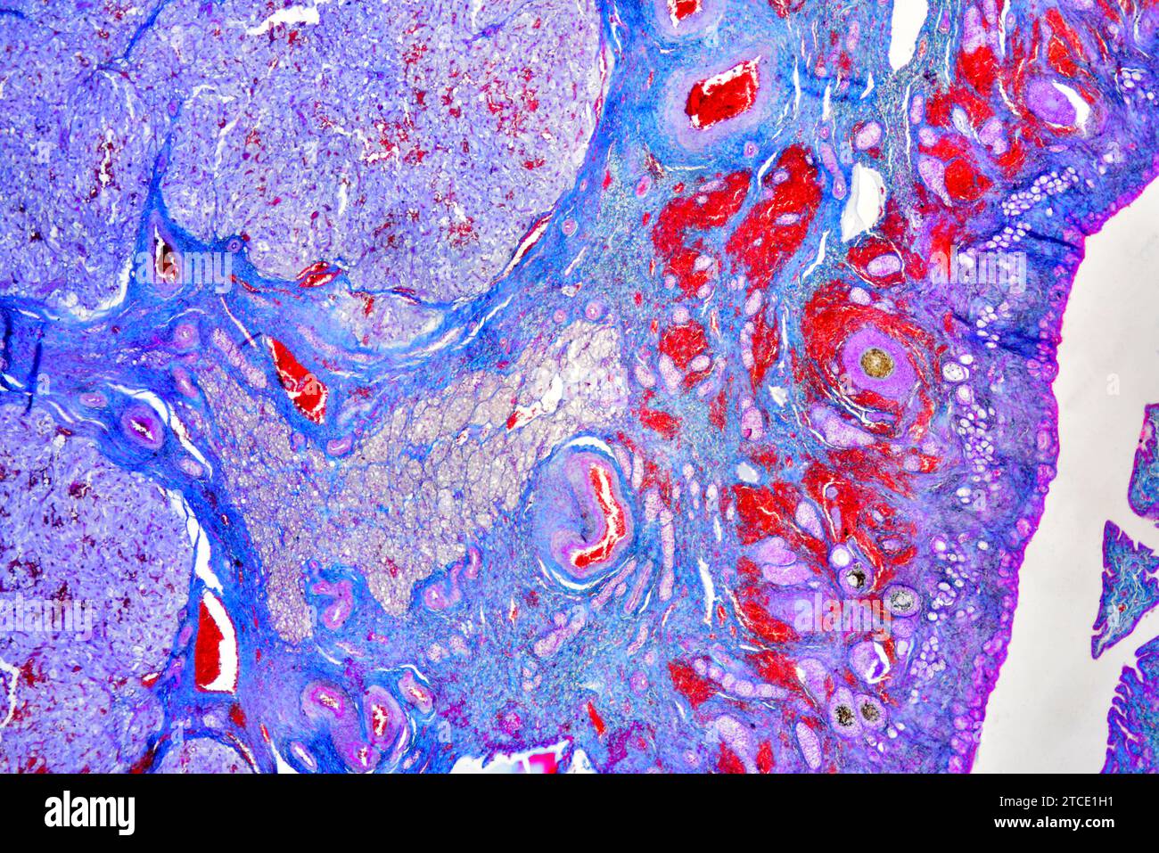 Human Corpus Luteum Slide Reproductive System Slide Set | Carolina