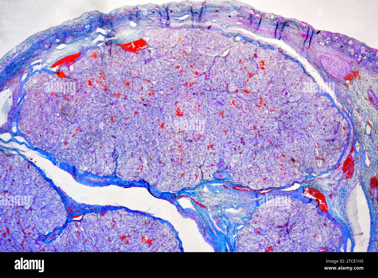 Human ovary section showing corpus luteum and epithelium. Optical ...
